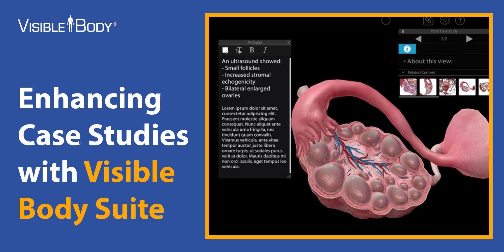 How to Enhance Case Studies with Tours in VB Suite